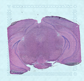 New Cryostat Enhances Precision in Cancer Research at IICD | Columbia ...